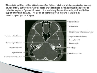 SKULL BASE OVERVIEW anatomy anteroir middle and posterior | PPT