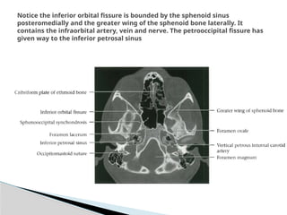 SKULL BASE OVERVIEW anatomy anteroir middle and posterior | PPT