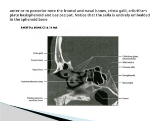 SKULL BASE OVERVIEW anatomy anteroir middle and posterior | PPTX