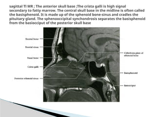 SKULL BASE OVERVIEW anatomy anteroir middle and posterior | PPTX