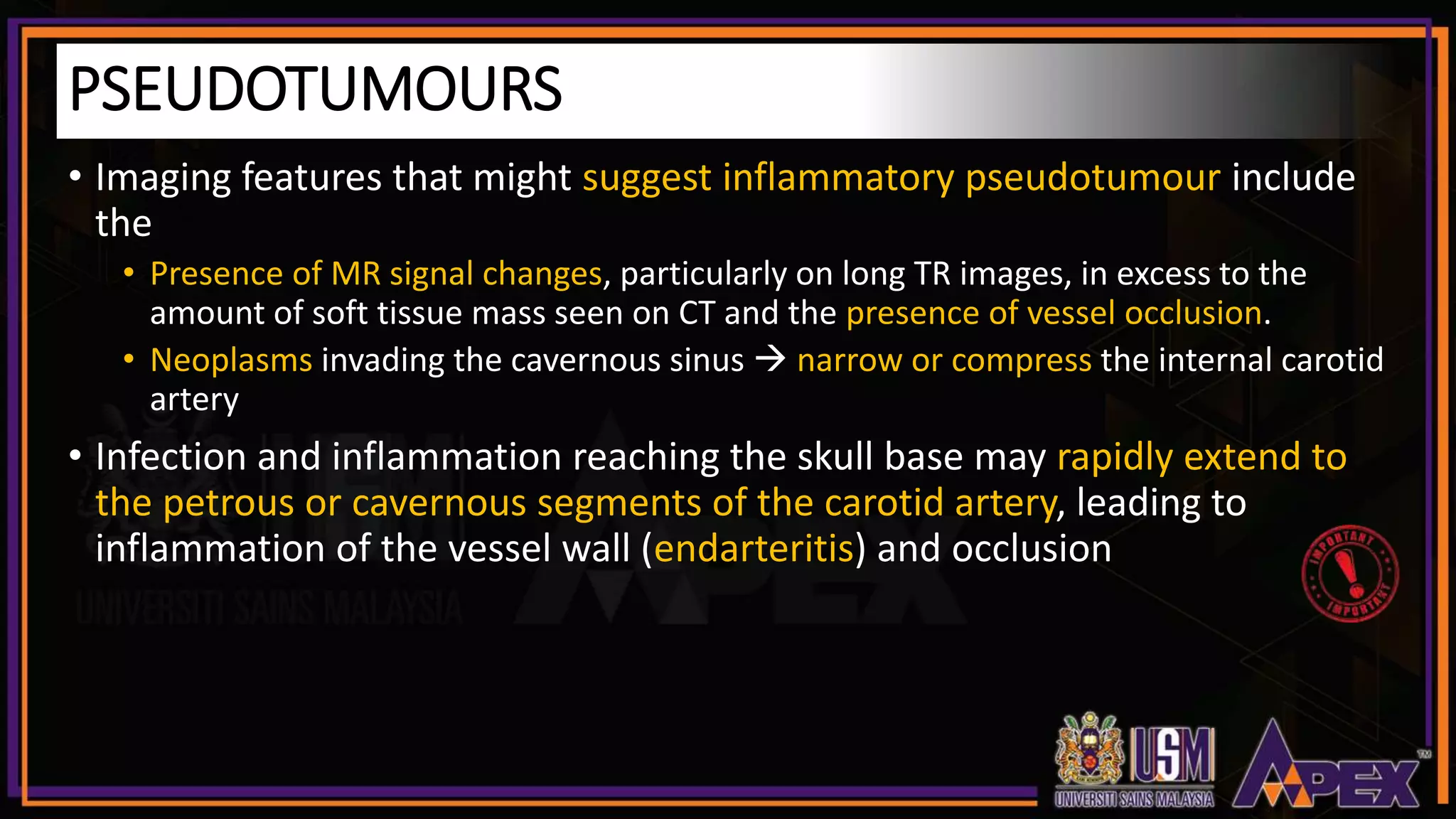 Skull Base Radiology and Ddx.pptx