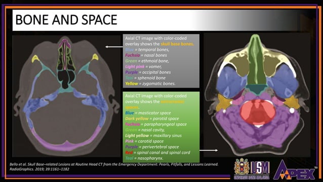 Skull Base Radiology and Ddx.pptx