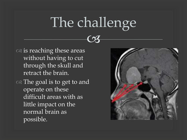 SKULL BASE SURGERY.pptx