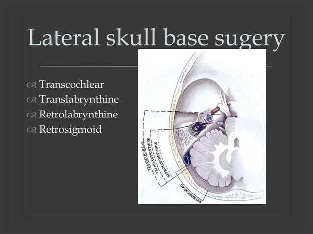 SKULL BASE SURGERY.pptx