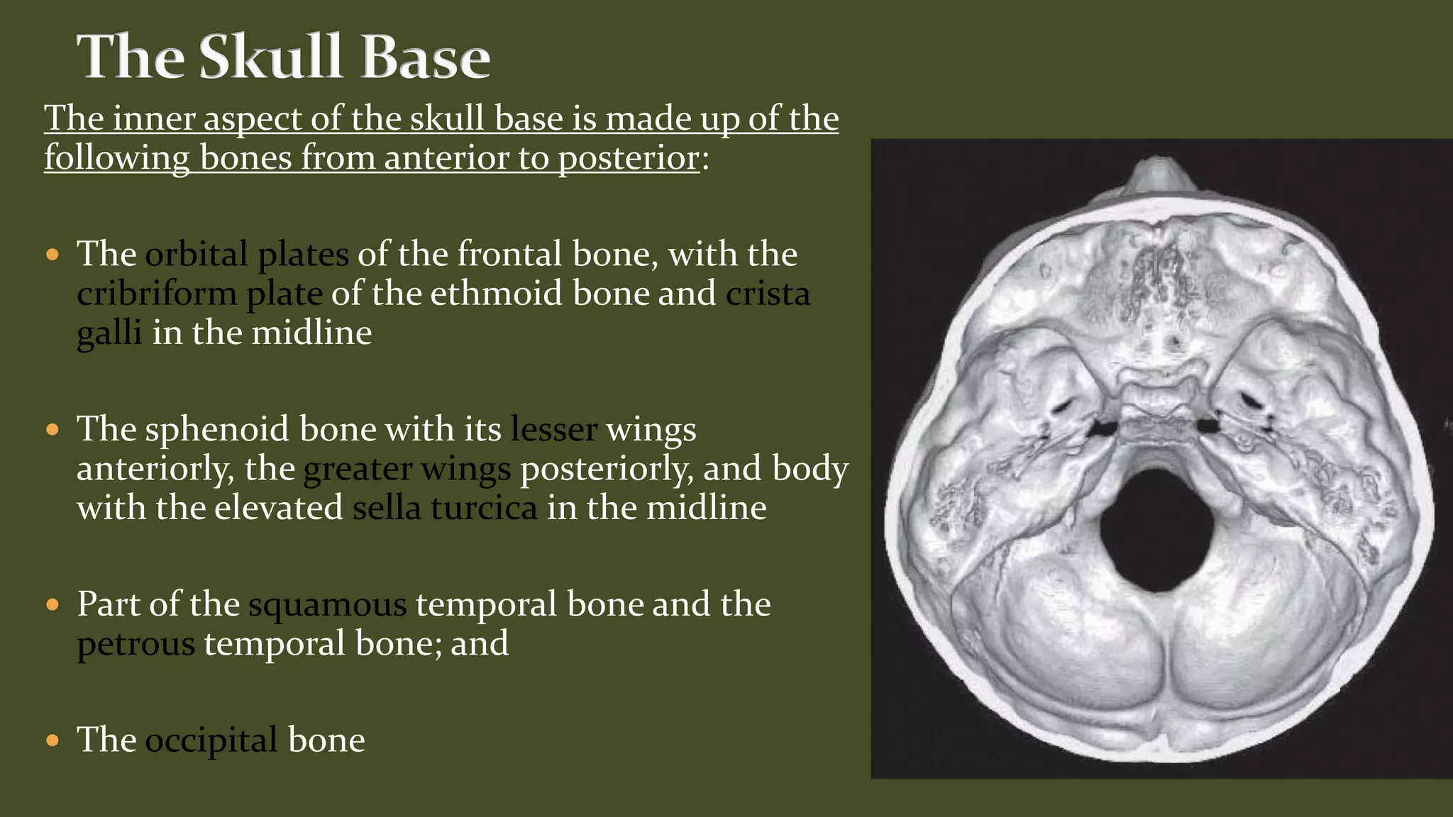 Skull base tumors & perineural spread radiology ppt | PPTX