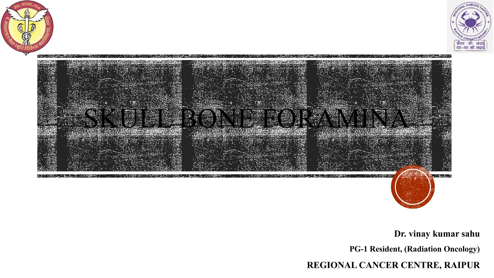 Skull bone Foramen and its contents.pptx