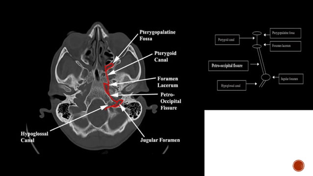 Skull bone Foramen and its contents.pptx