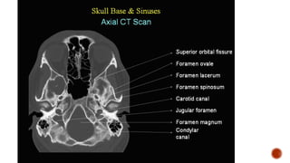 Skull bone Foramen and its contents.pptx