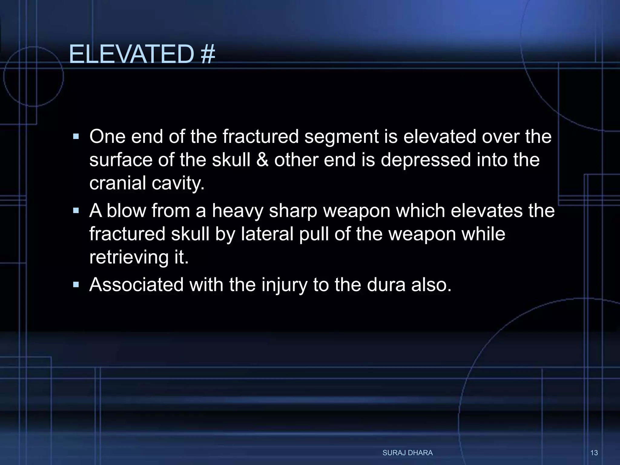 Skull fractures (Regional injury part - 1) | PPTX