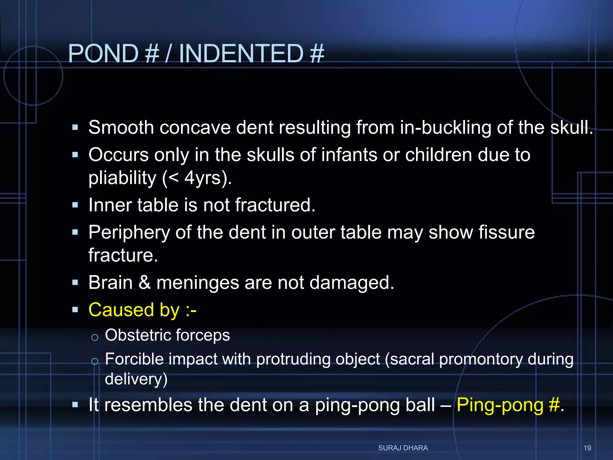 Skull fractures (Regional injury part - 1) | PPTX