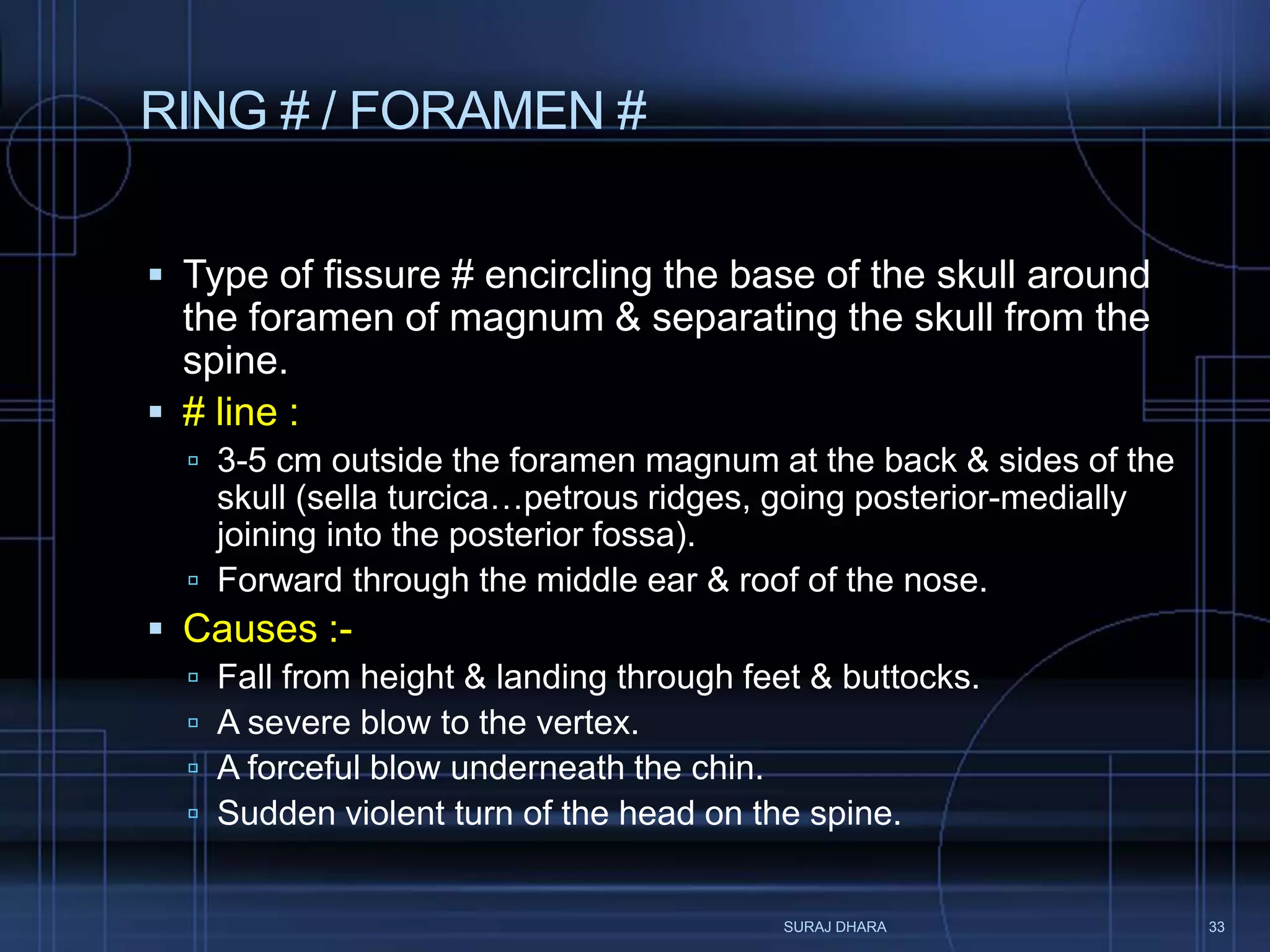 Skull fractures (Regional injury part - 1) | PPTX