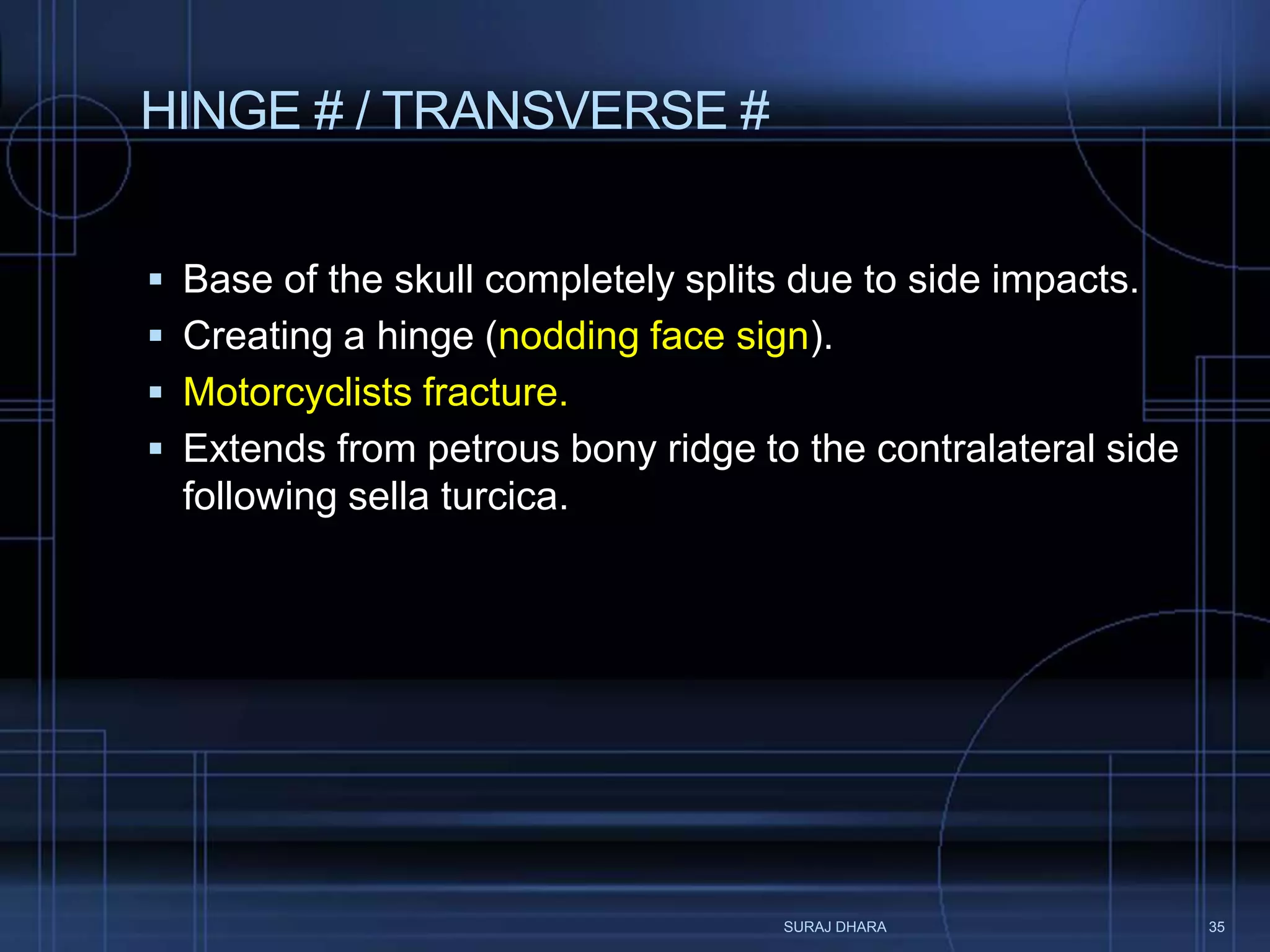 Skull fractures (Regional injury part - 1) | PPTX