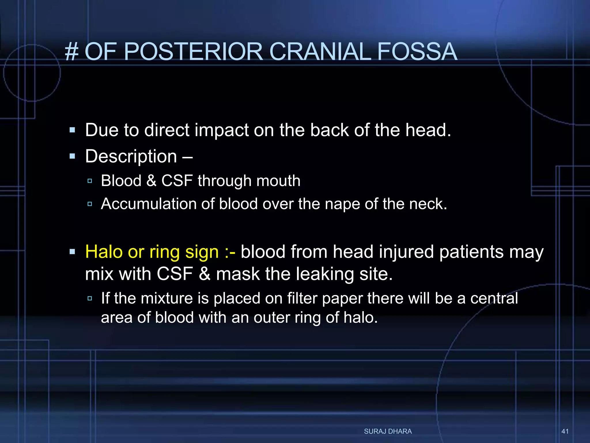 Skull fractures (Regional injury part - 1) | PPTX