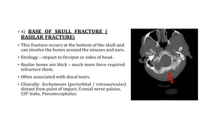 skull fractures.pdf | Death, Injury, or Military Conflict | Sensitive Topics