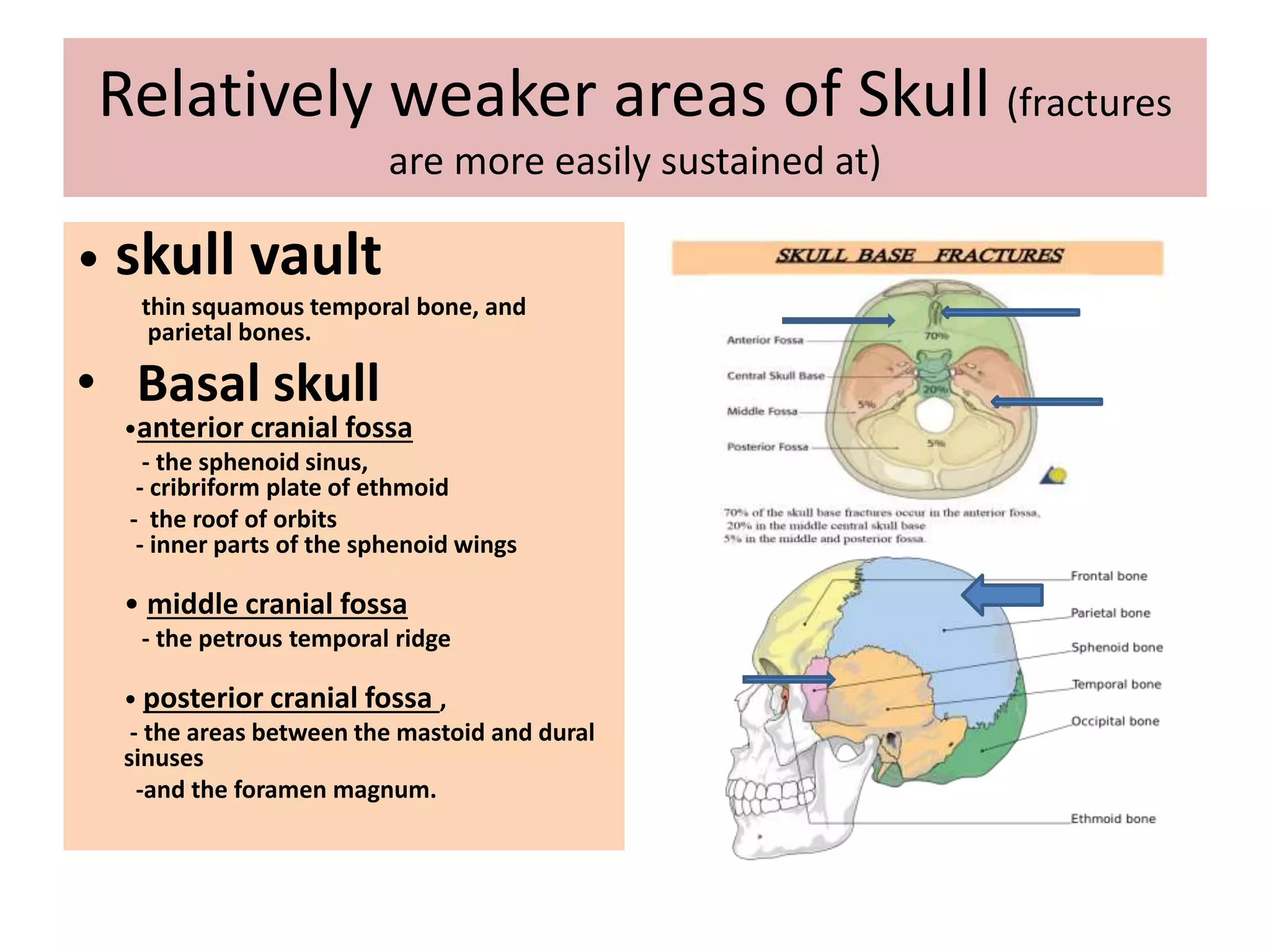 Skull fractures- forensic aspects MBsingh,S.Dhara,DrY.Hameed | PPTX