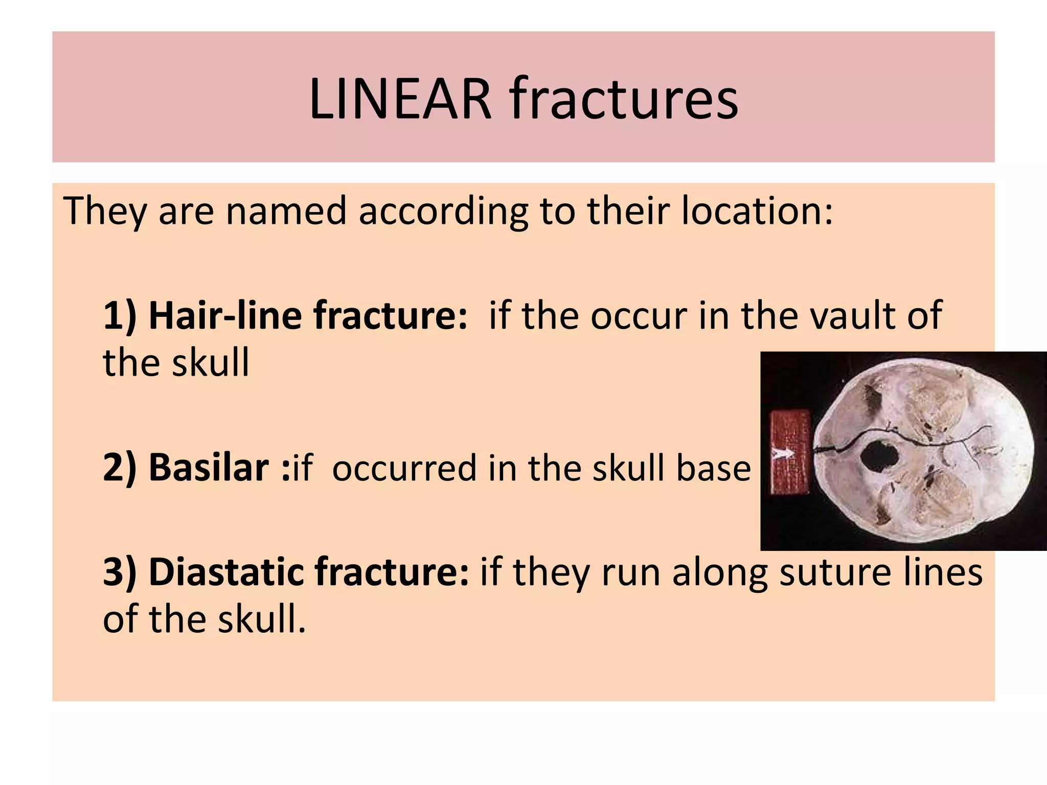 Skull fractures- forensic aspects MBsingh,S.Dhara,DrY.Hameed | PPTX