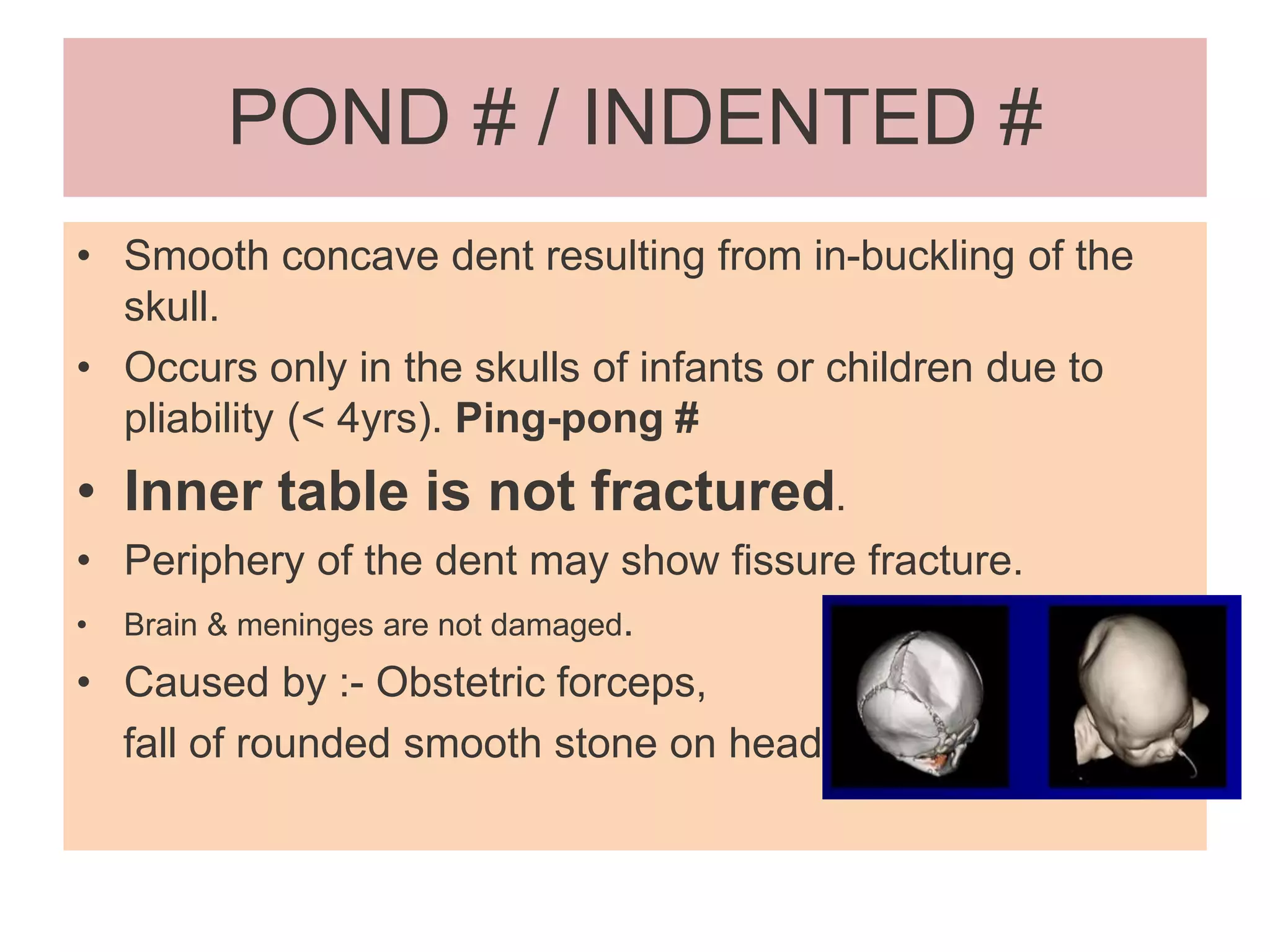 Skull fractures- forensic aspects MBsingh,S.Dhara,DrY.Hameed | PPTX