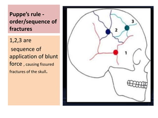 Skull fractures- forensic aspects MBsingh,S.Dhara,DrY.Hameed | PPT