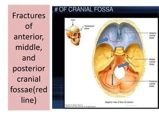 Anterior Fossa Fracture