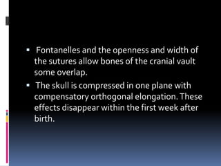 Skull in newborn by DR.ARSHAD | PPTX