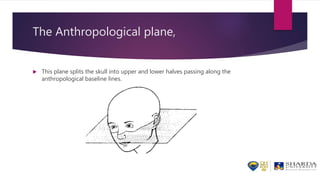 Skull landmark | PPTX