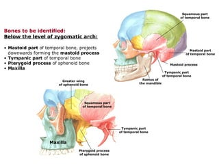 Skull masters | PPT