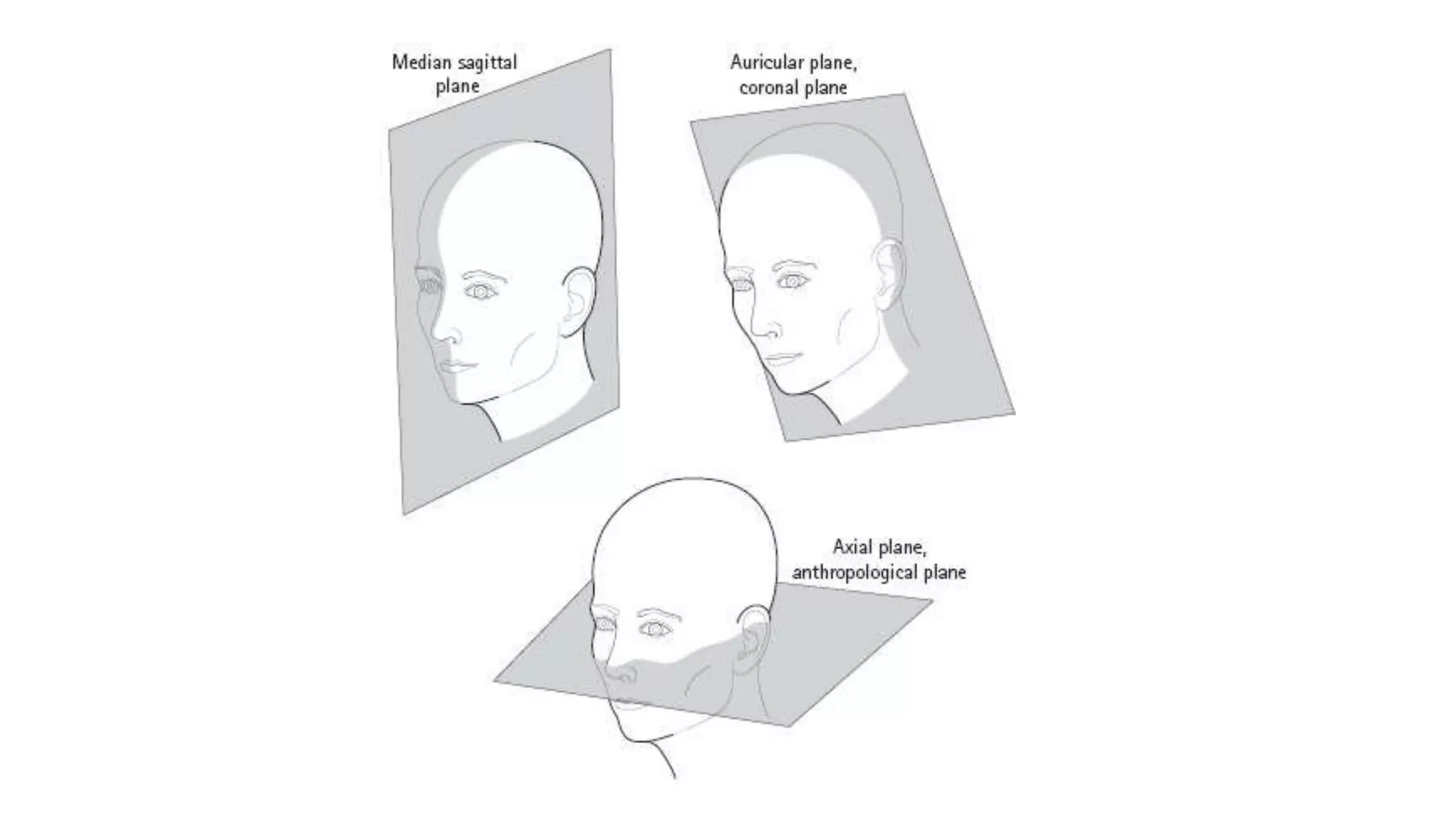 Skull,orbit temporal bones,facial bones,paranasal sinuses,mandible and ...