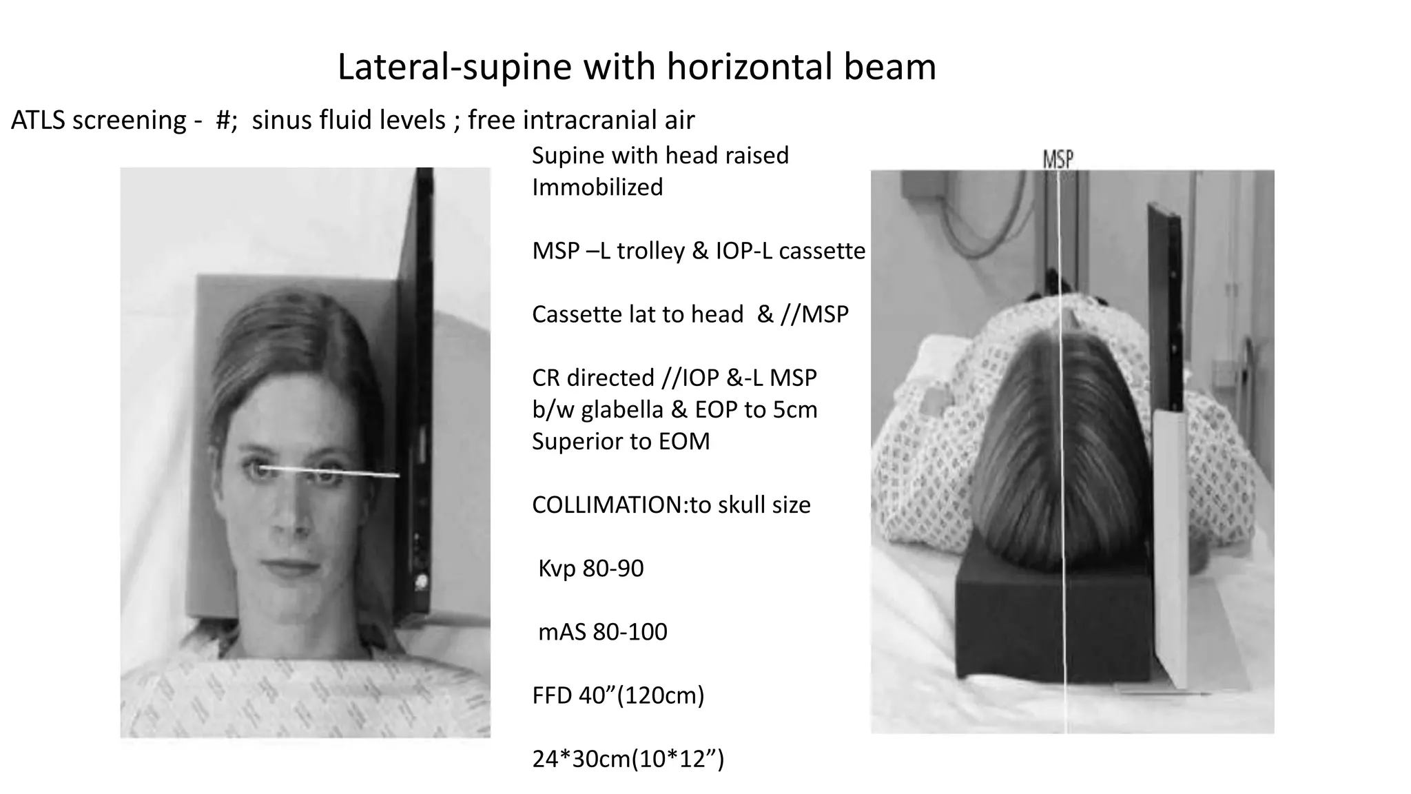 Skull,orbit temporal bones,facial bones,paranasal sinuses,mandible and ...