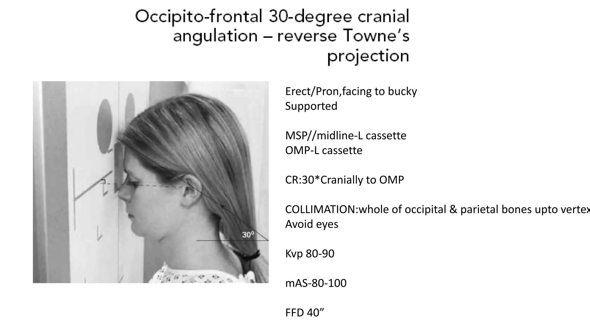 Skull,orbit temporal bones,facial bones,paranasal sinuses,mandible and ...