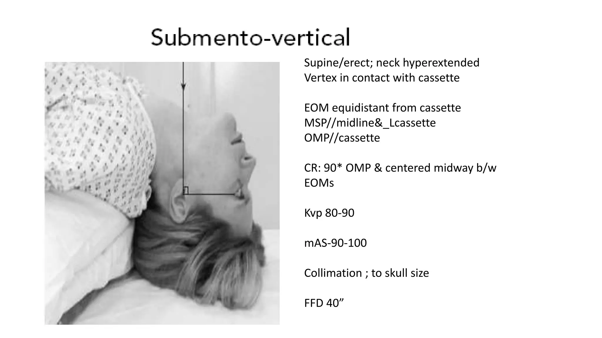Skull,orbit temporal bones,facial bones,paranasal sinuses,mandible and ...