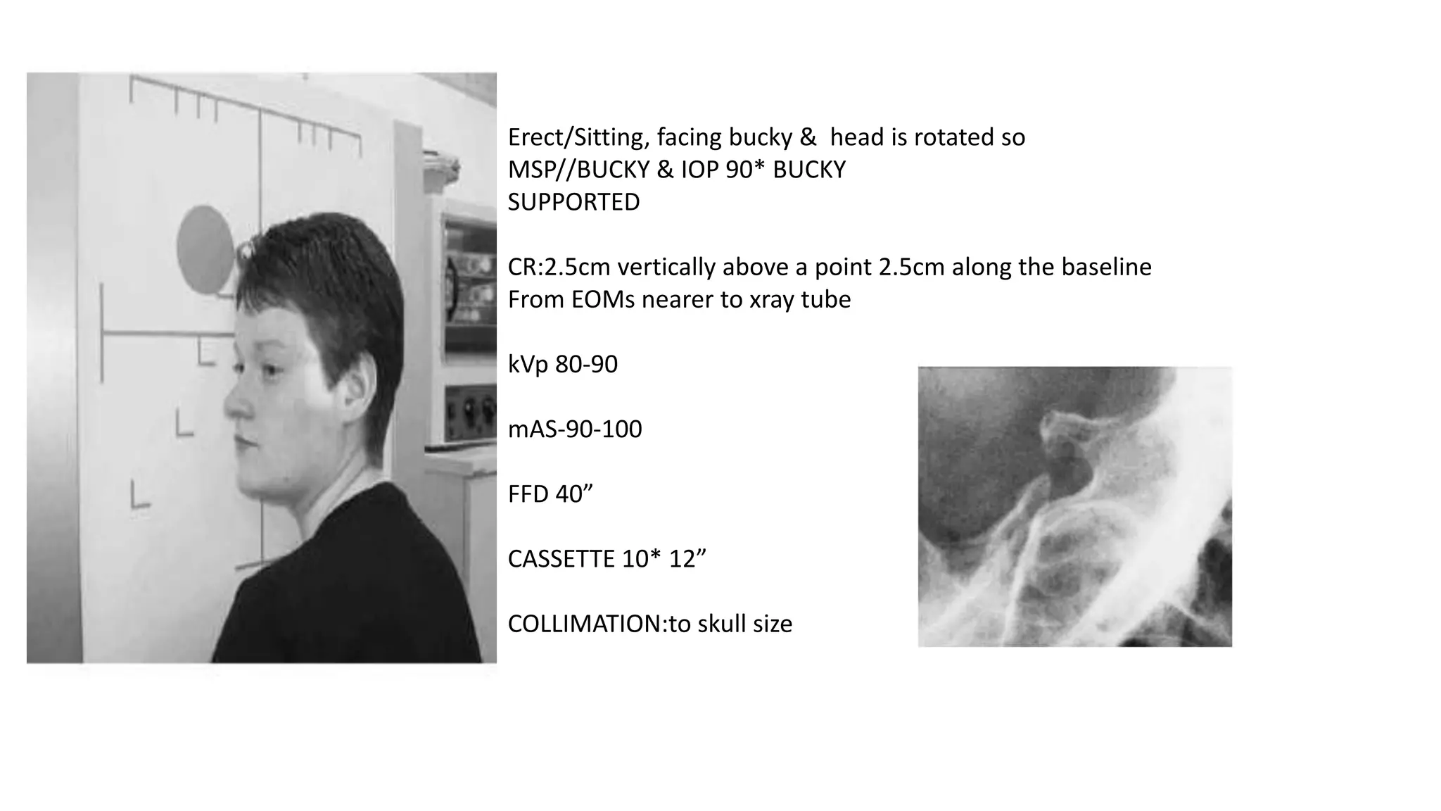 Skull,orbit temporal bones,facial bones,paranasal sinuses,mandible and ...