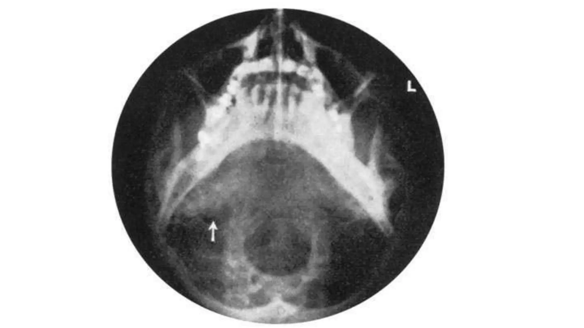 Skull,orbit temporal bones,facial bones,paranasal sinuses,mandible and ...