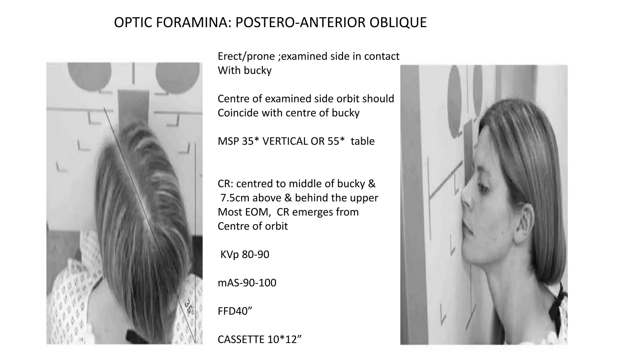 Skull,orbit temporal bones,facial bones,paranasal sinuses,mandible and ...