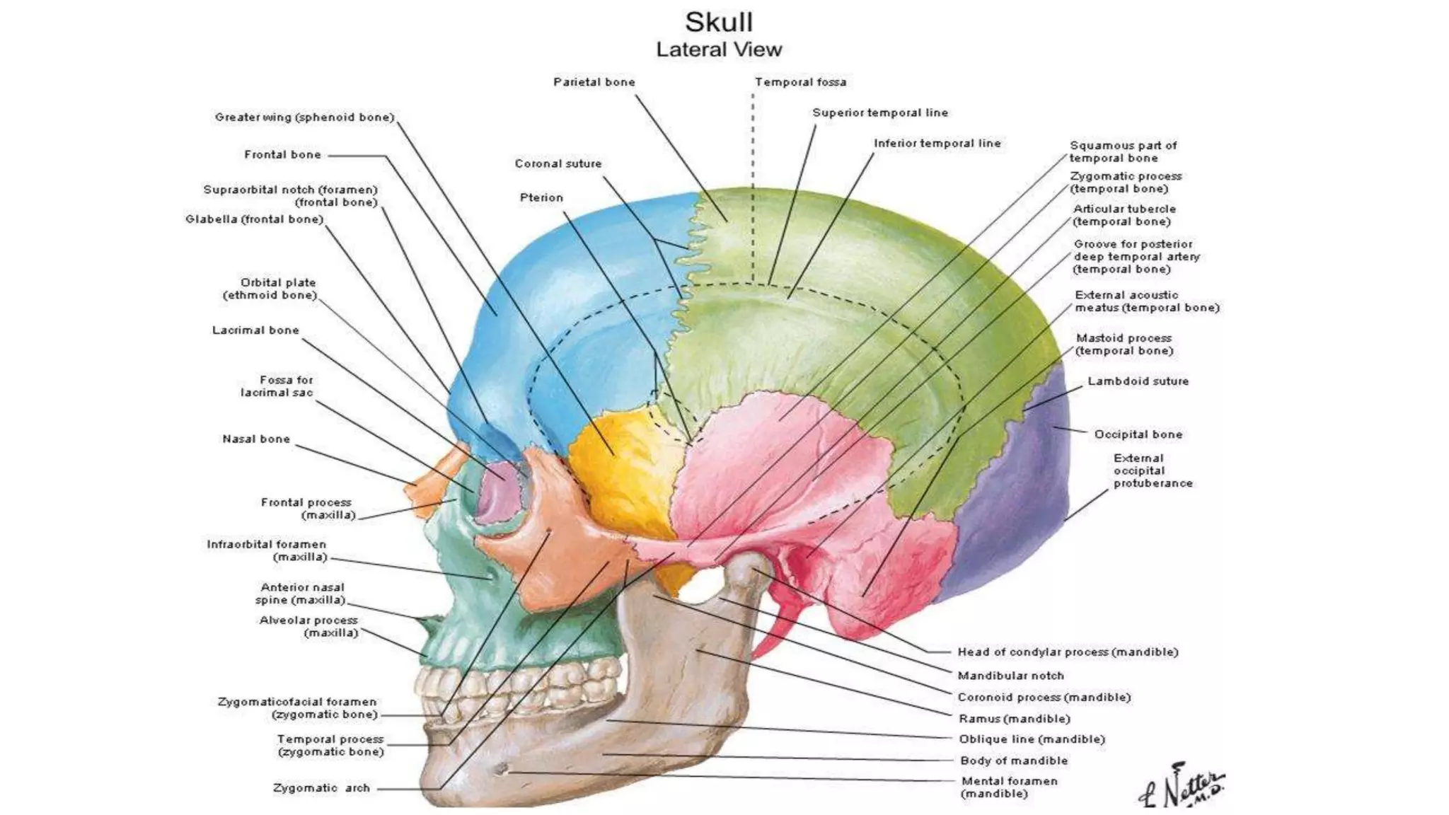 Skull,orbit temporal bones,facial bones,paranasal sinuses,mandible and ...