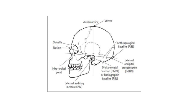 Skull,orbit temporal bones,facial bones,paranasal sinuses,mandible and ...