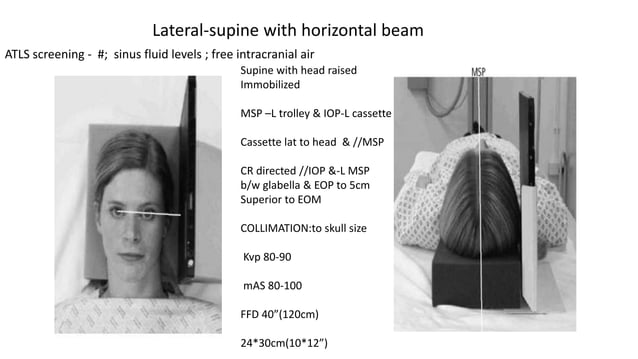 Skull,orbit temporal bones,facial bones,paranasal sinuses,mandible and ...