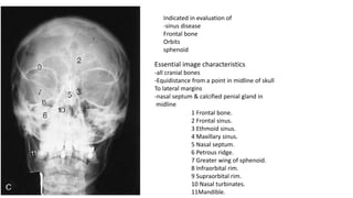 Skull,orbit temporal bones,facial bones,paranasal sinuses,mandible and ...