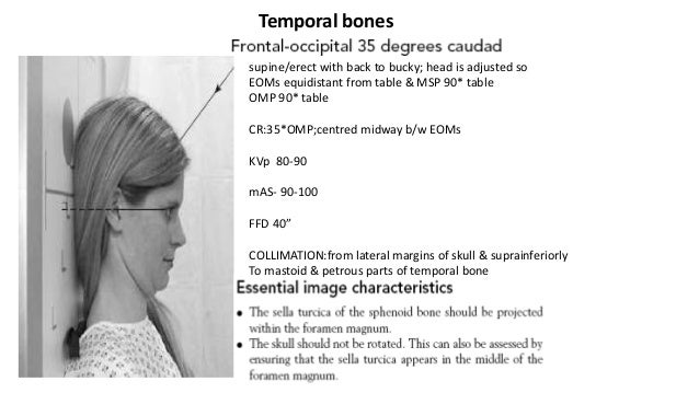 Skull,orbit temporal bones,facial bones,paranasal sinuses,mandible an…
