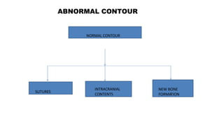 Skull pathologies on Xrays | PPTX