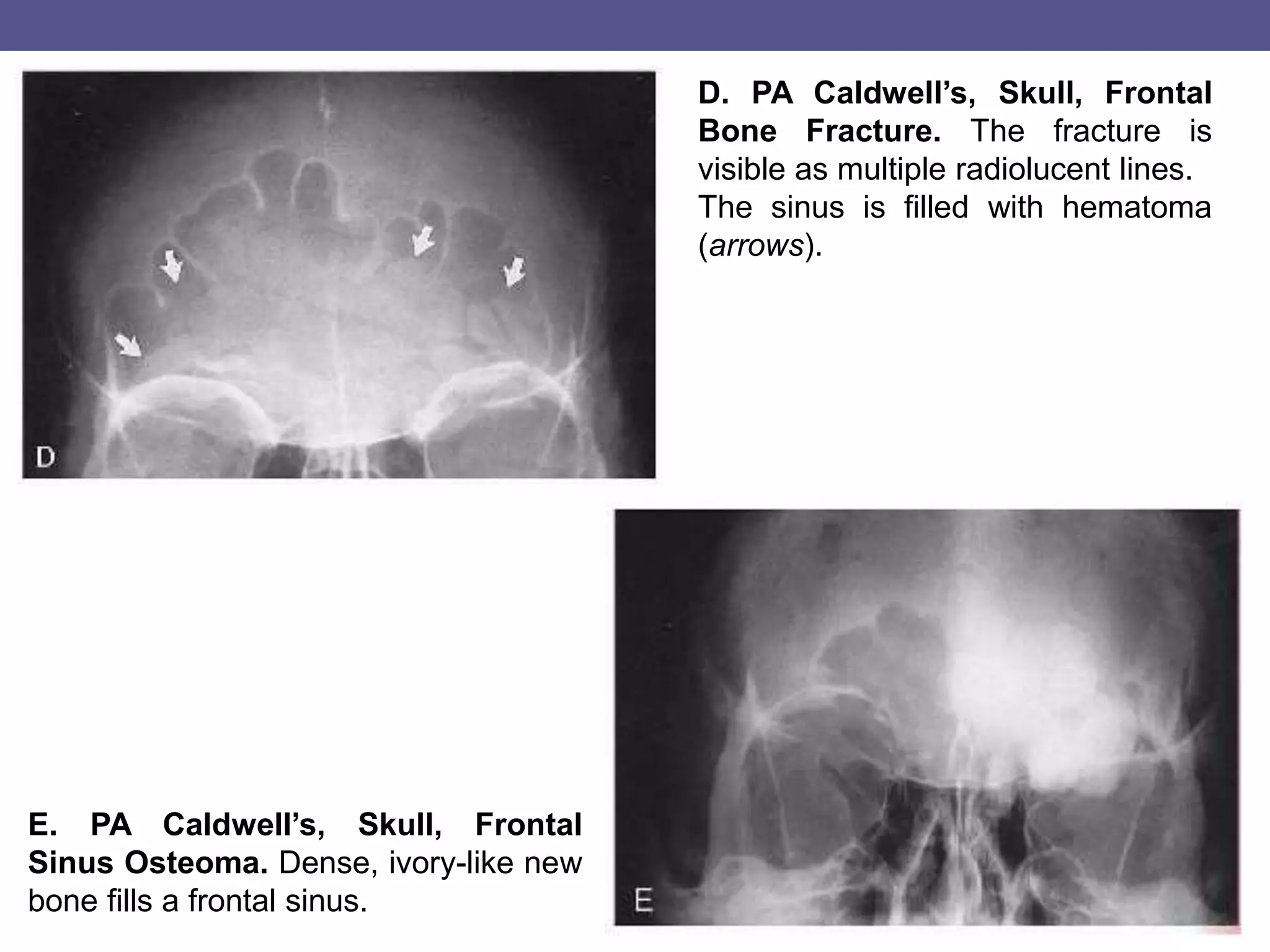 Skull, pns views.pot