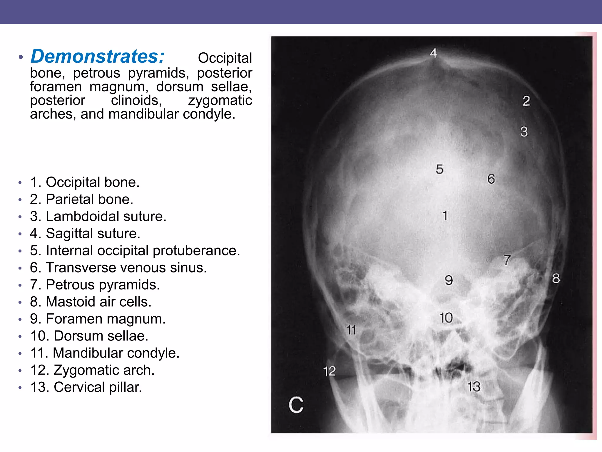 Skull, pns views.pot