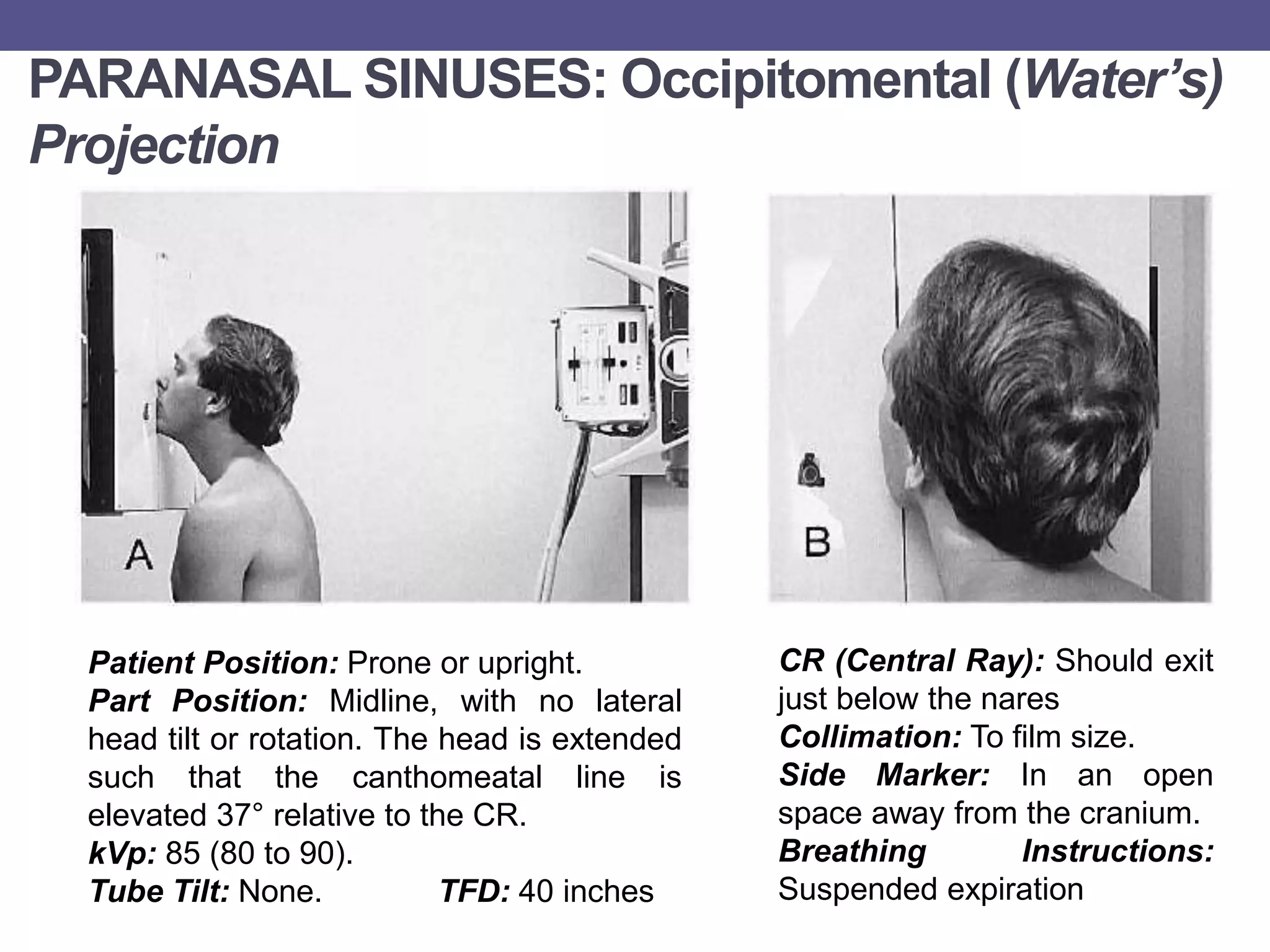 Skull, pns views.pot