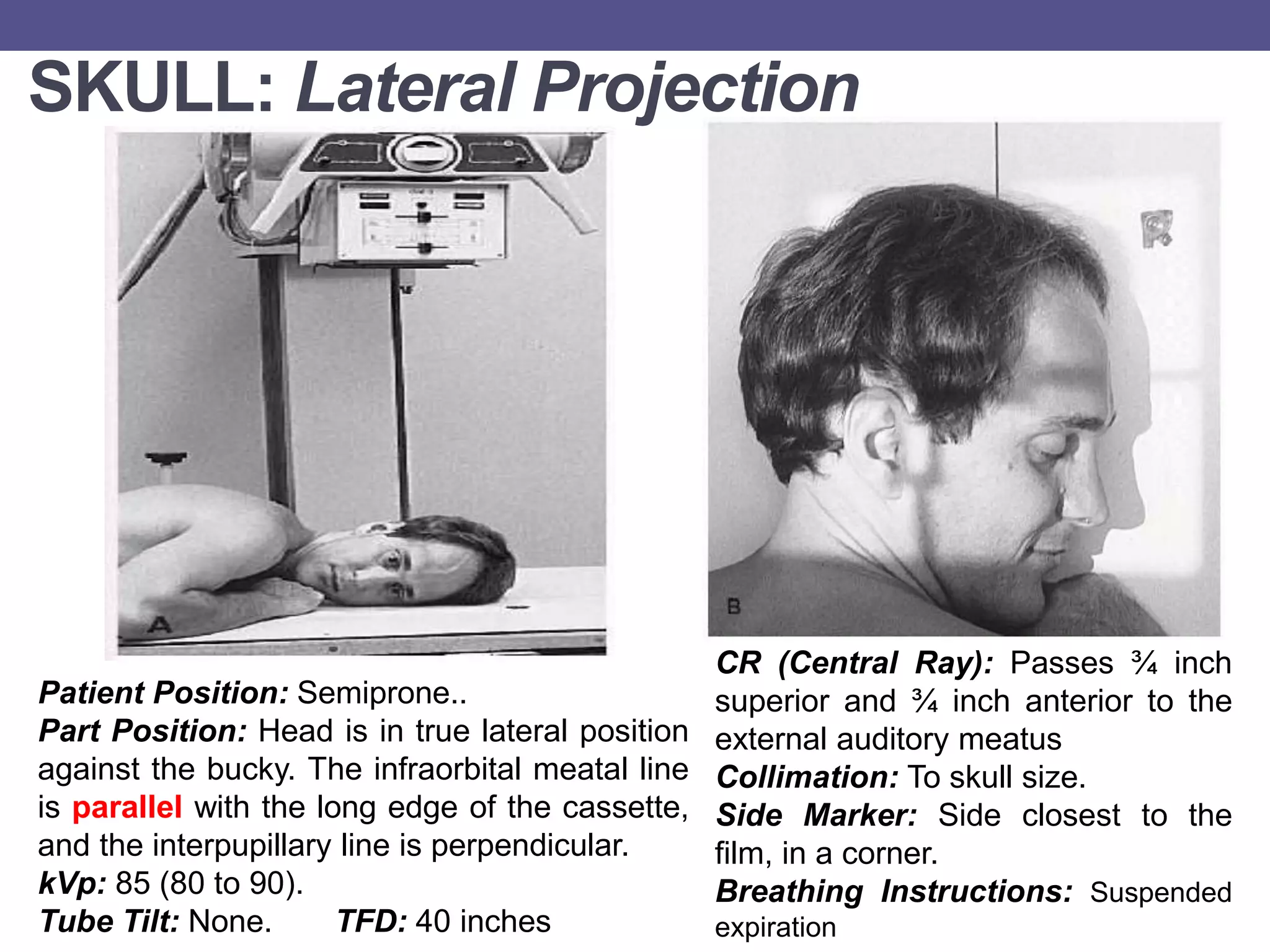 Skull, pns views.pot