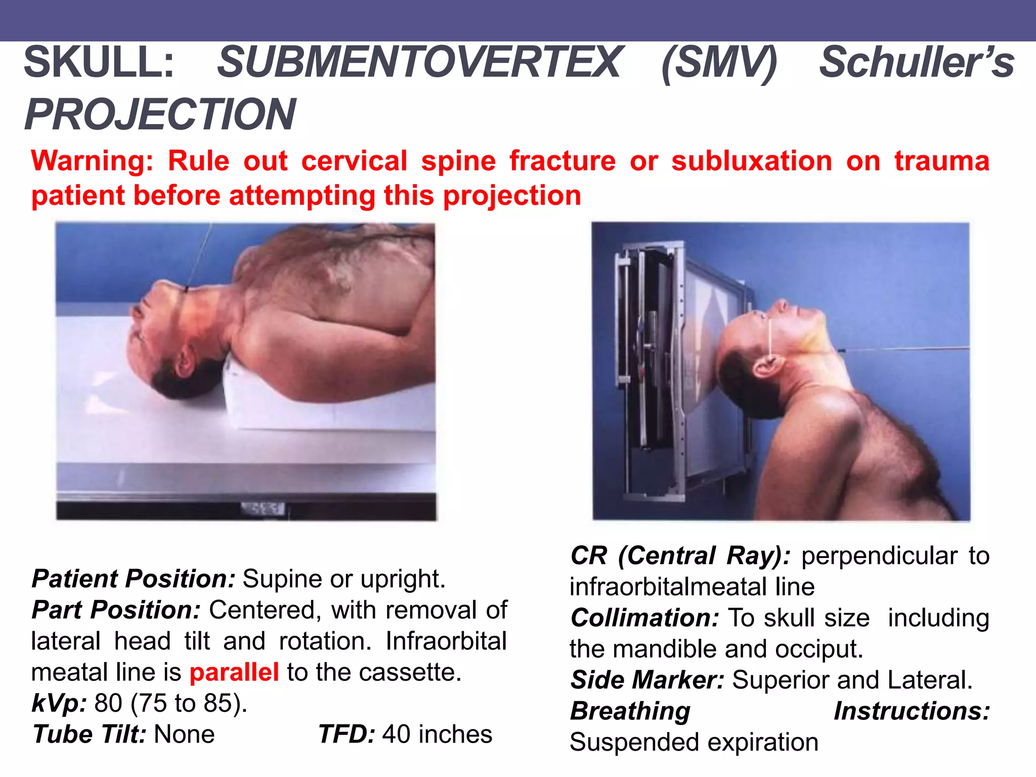 Skull, pns views.pot