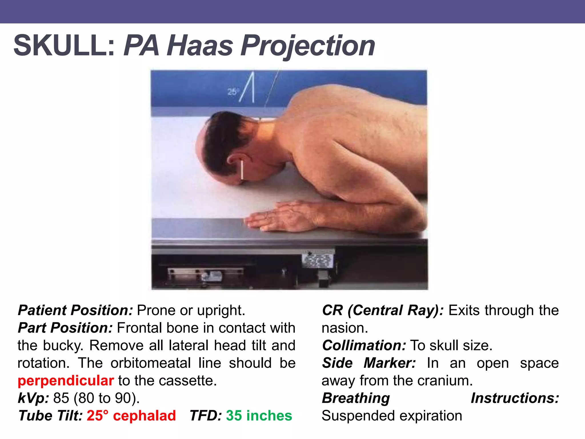 Skull, pns views.pot