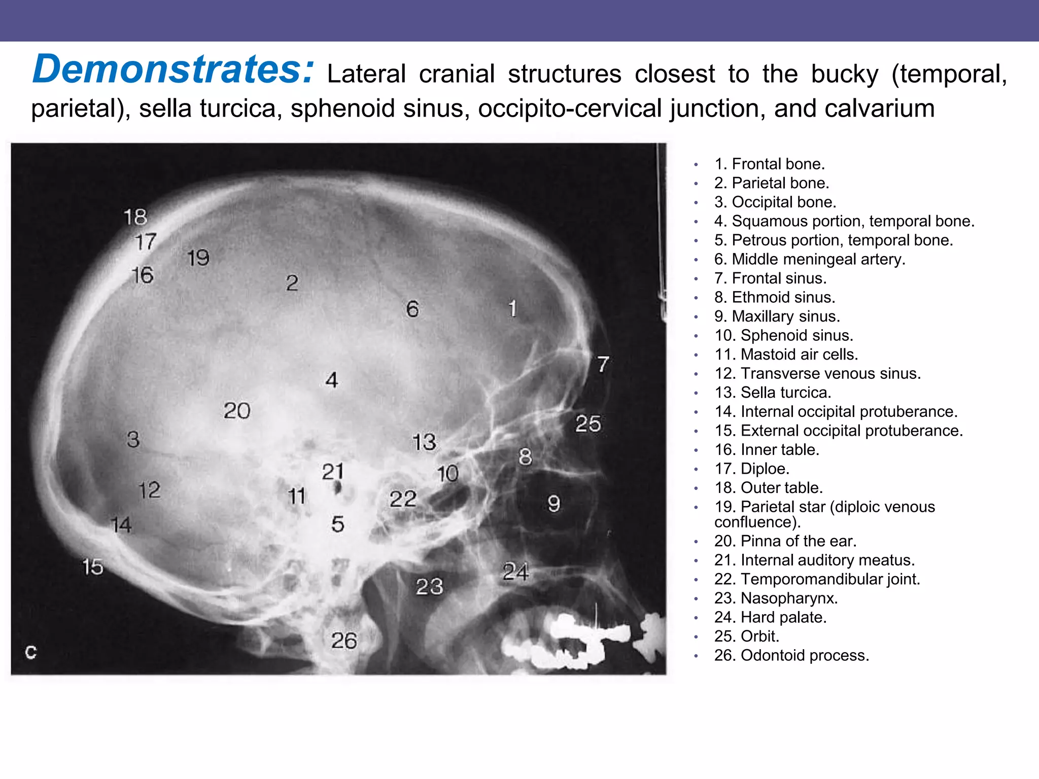 Skull, pns views.pot
