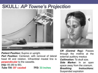 Skull, pns views.pot