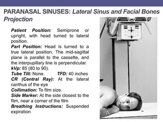 Skull, pns views.pot