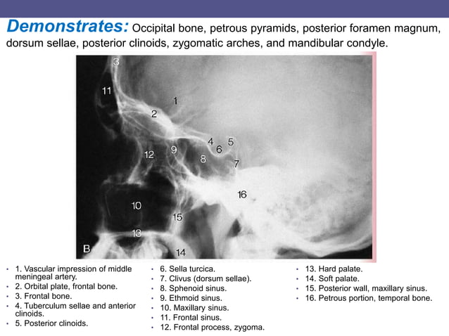Skull, pns views.pot