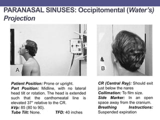 Skull, pns views.pot